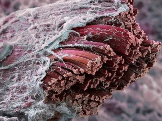 What is Fascia? - FASCIA TRAINING ACADEMY